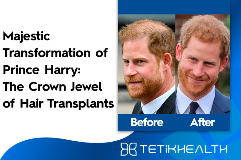 MAJESTIC TRANSFORMATION OF PRINCE HARRY: The Crown Jewel of Hair ...